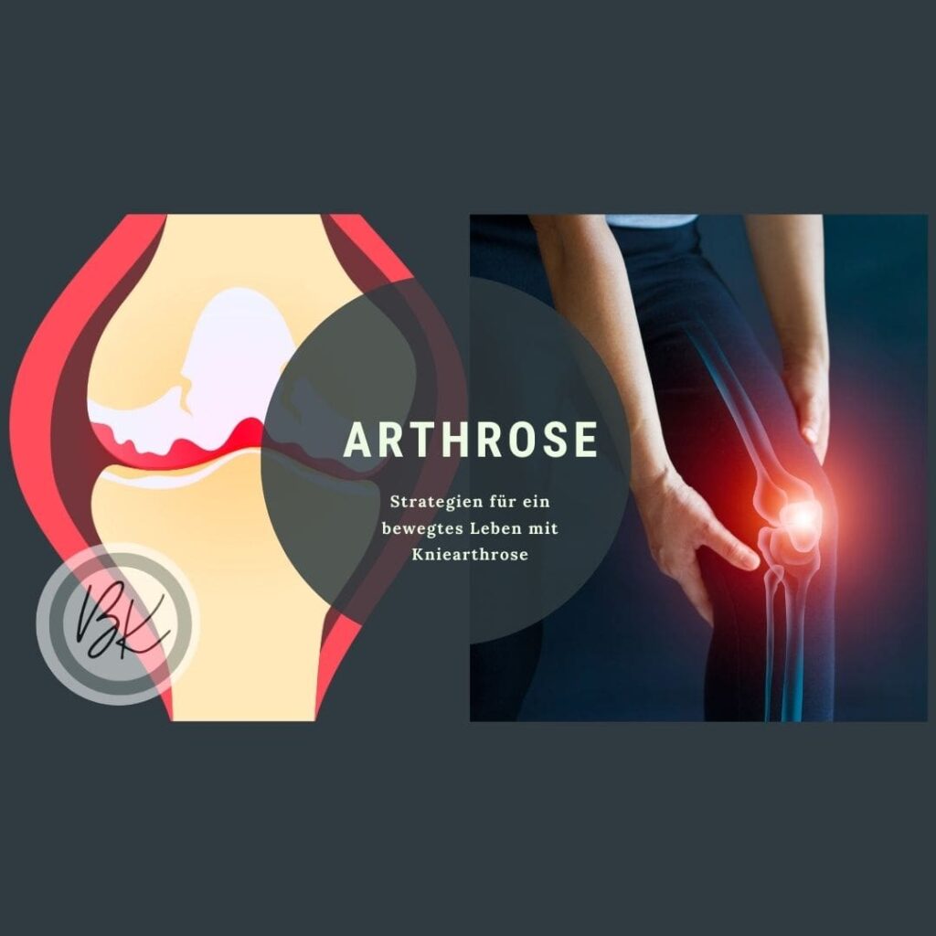 Die 7 besten Übungen zur Kräftigung bei Kniearthrose - Beckys Knie