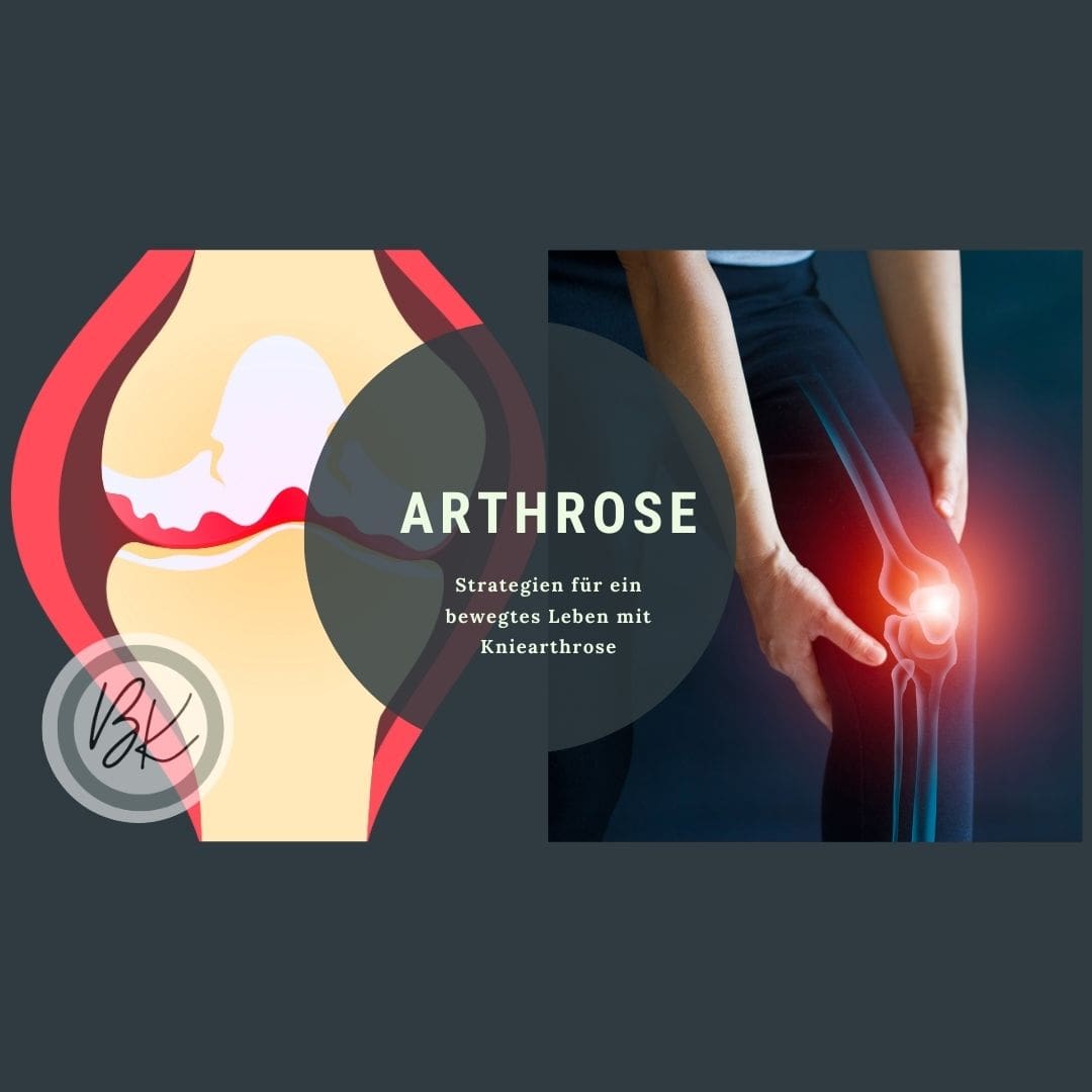 Die 7 besten Übungen zur Kräftigung bei Kniearthrose - Beckys Knie